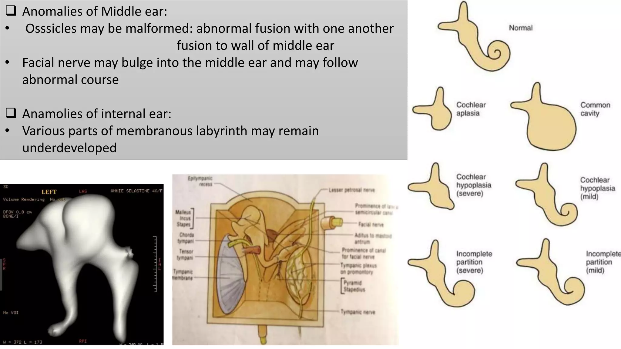 Development of ear | PPTX