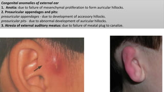 Development of ear | PPTX