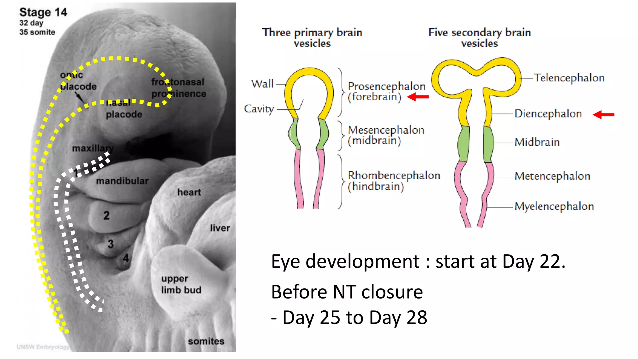 Development of eye. | PDF