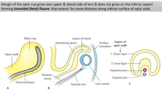 Development of eye | PPTX