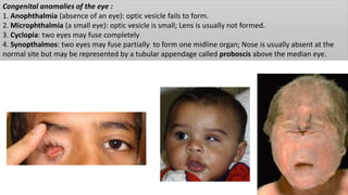 Development of eye | PPTX