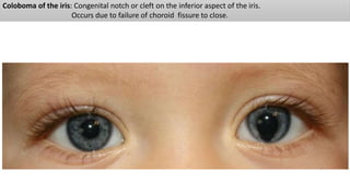 Development of eye | PPTX