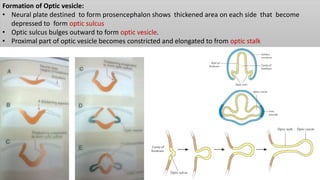 Development of eye | PPTX