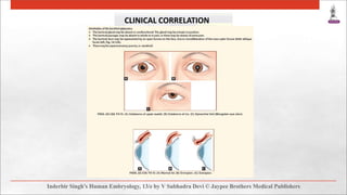 Embrylogy of Head & Neck-Development of eye1.pptx
