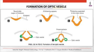 Embrylogy of Head & Neck-Development of eye1.pptx