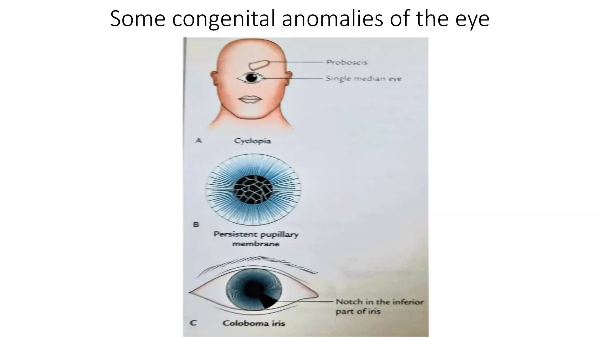 Development of Eye and Ear.pptx