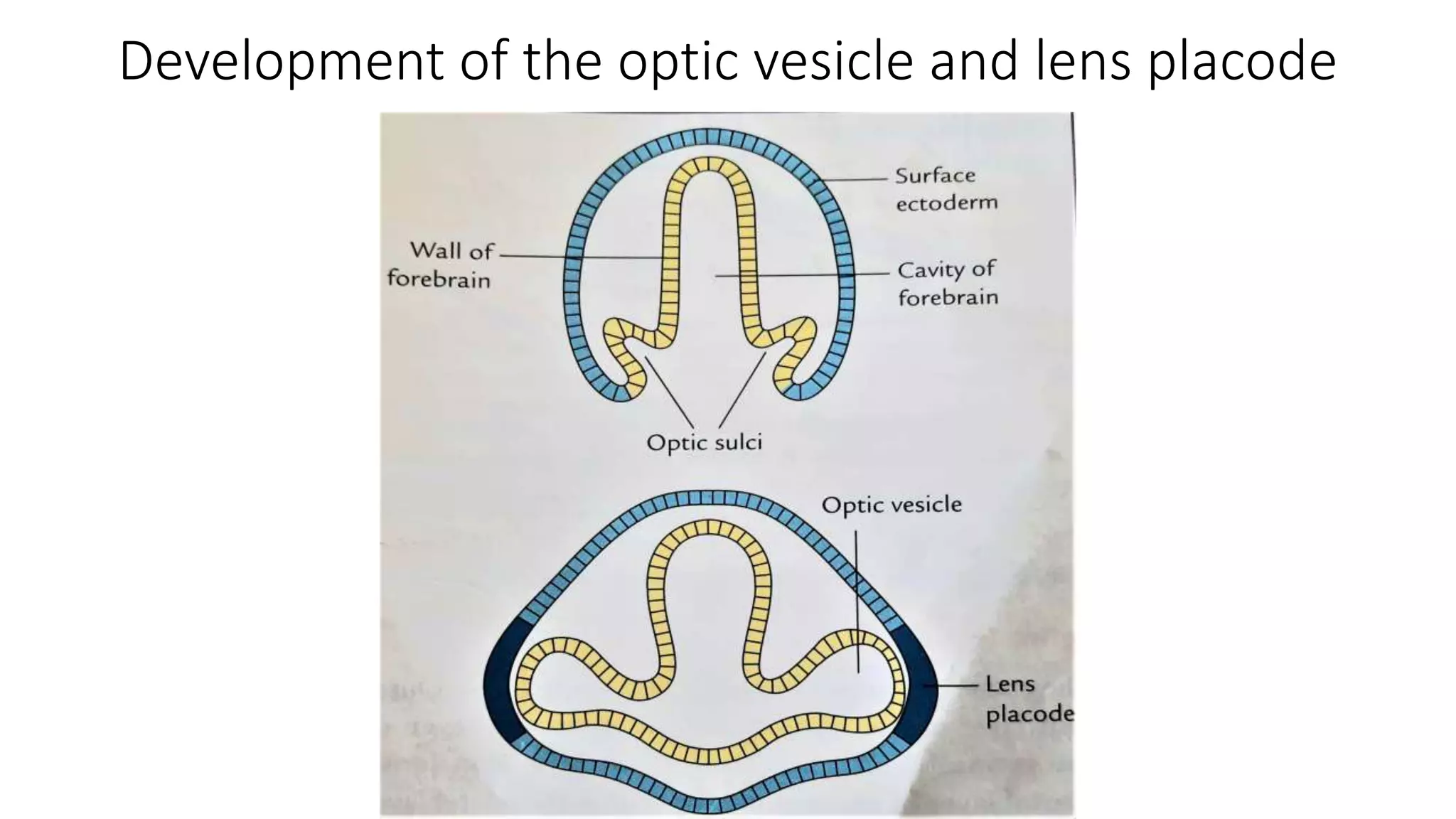 Development of Eye and Ear.pptx