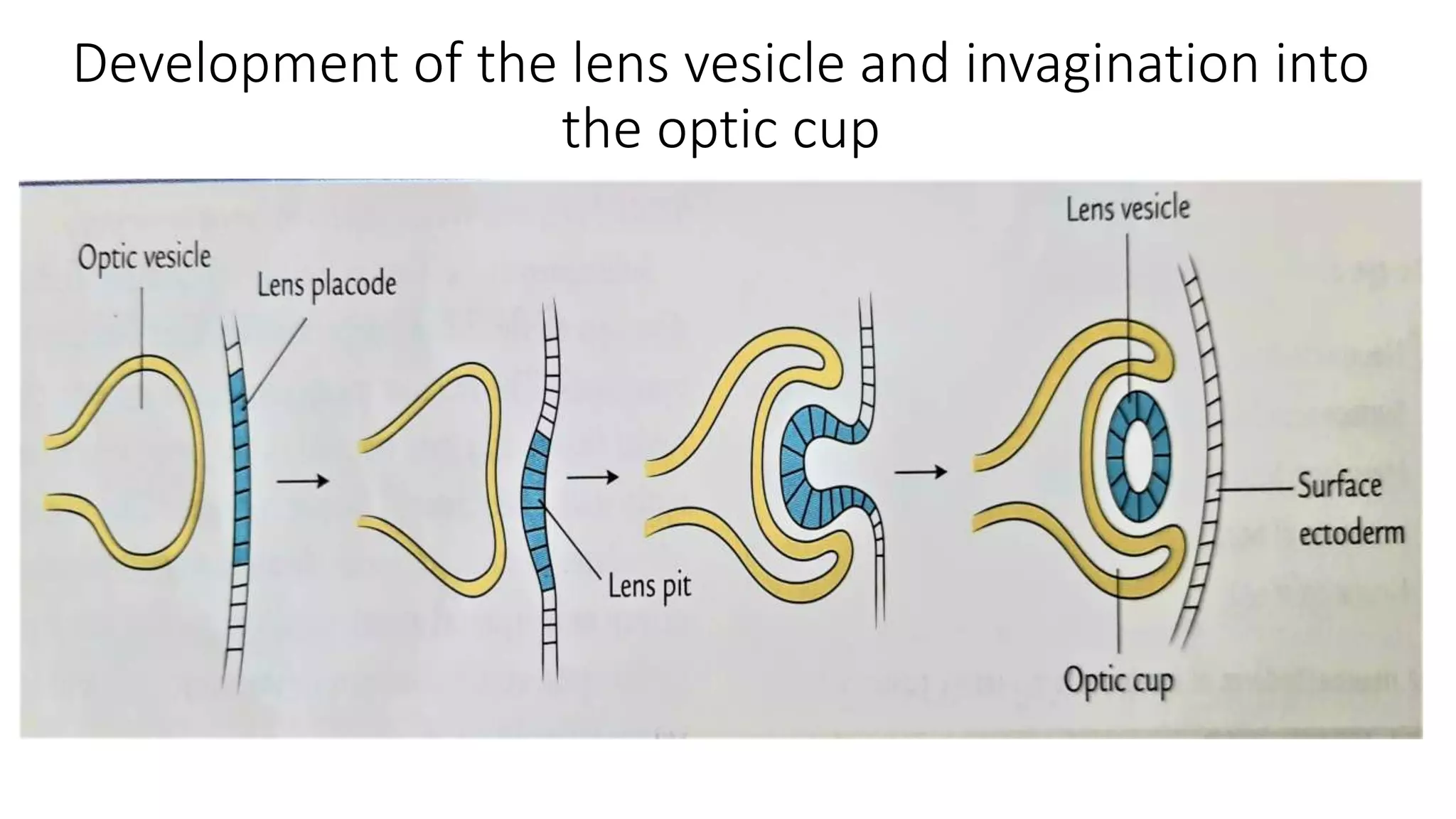 Development of Eye and Ear.pptx