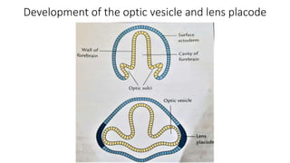 Development of Eye and Ear.pptx