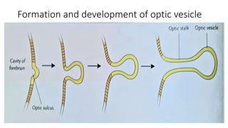 Development of Eye and Ear.pptx