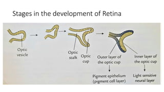 Development of Eye and Ear.pptx