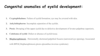 Development of a normal human Eyelid.pptx