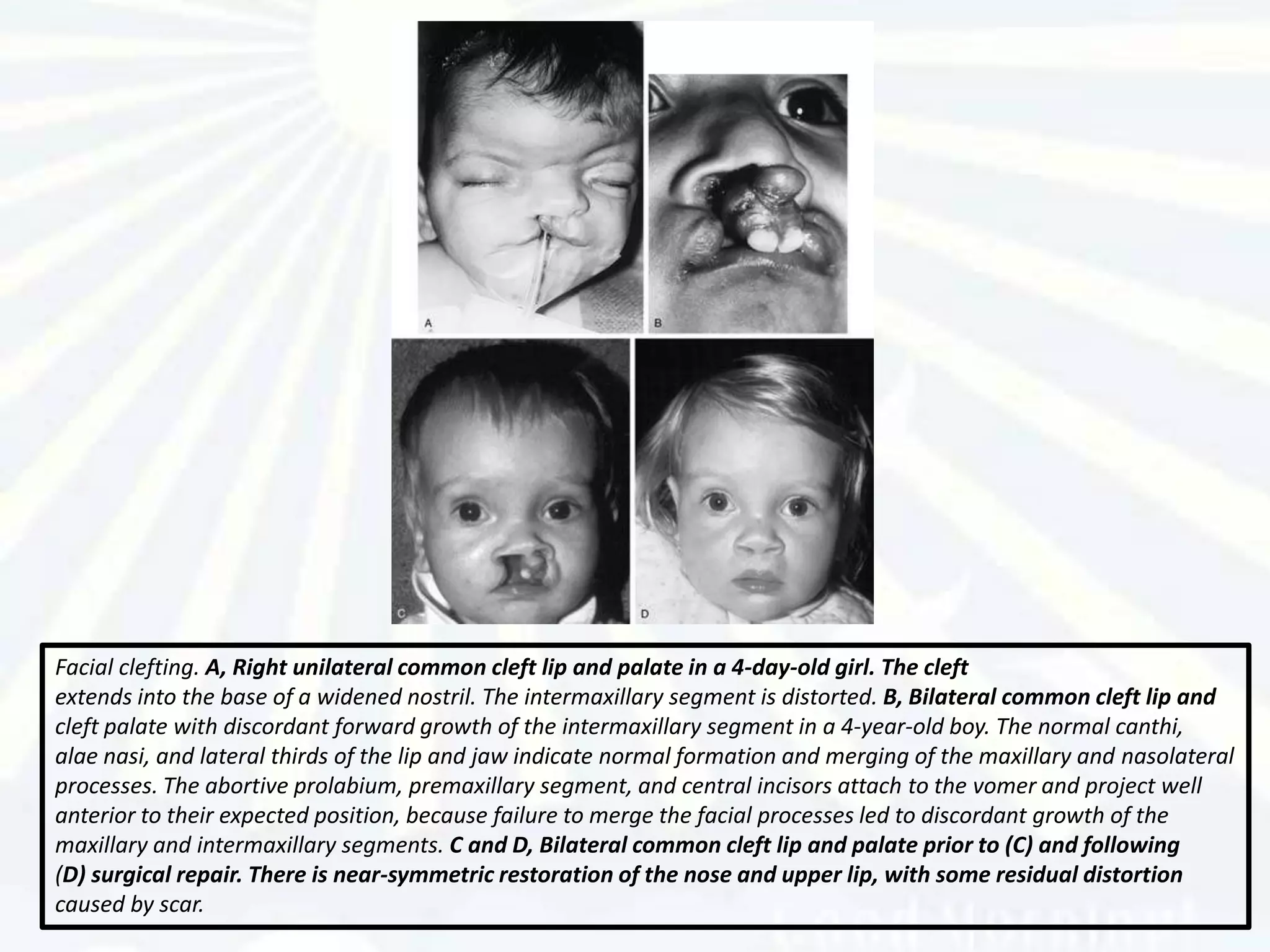 Development of face | PPTX