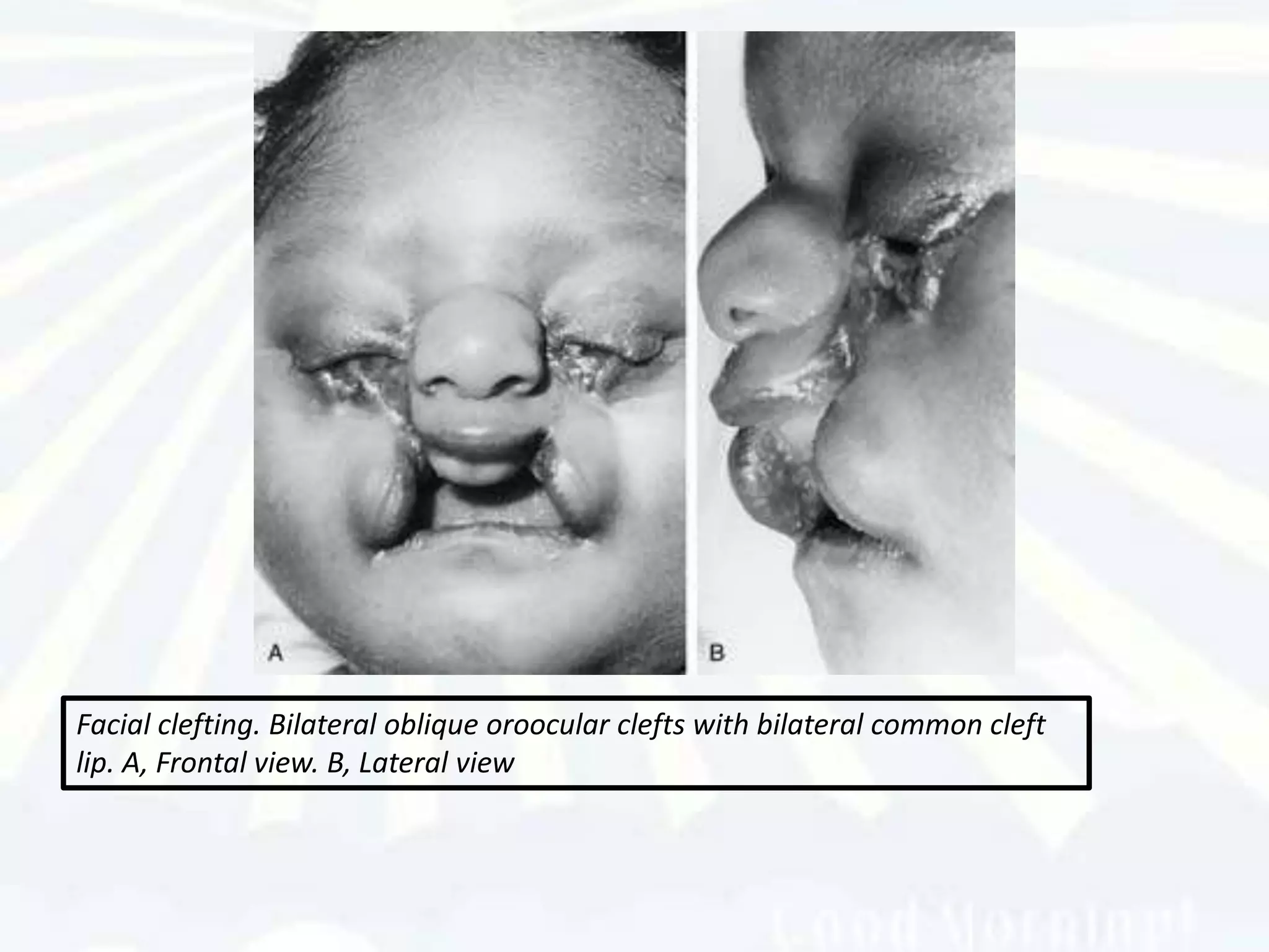 Development of face | PPTX