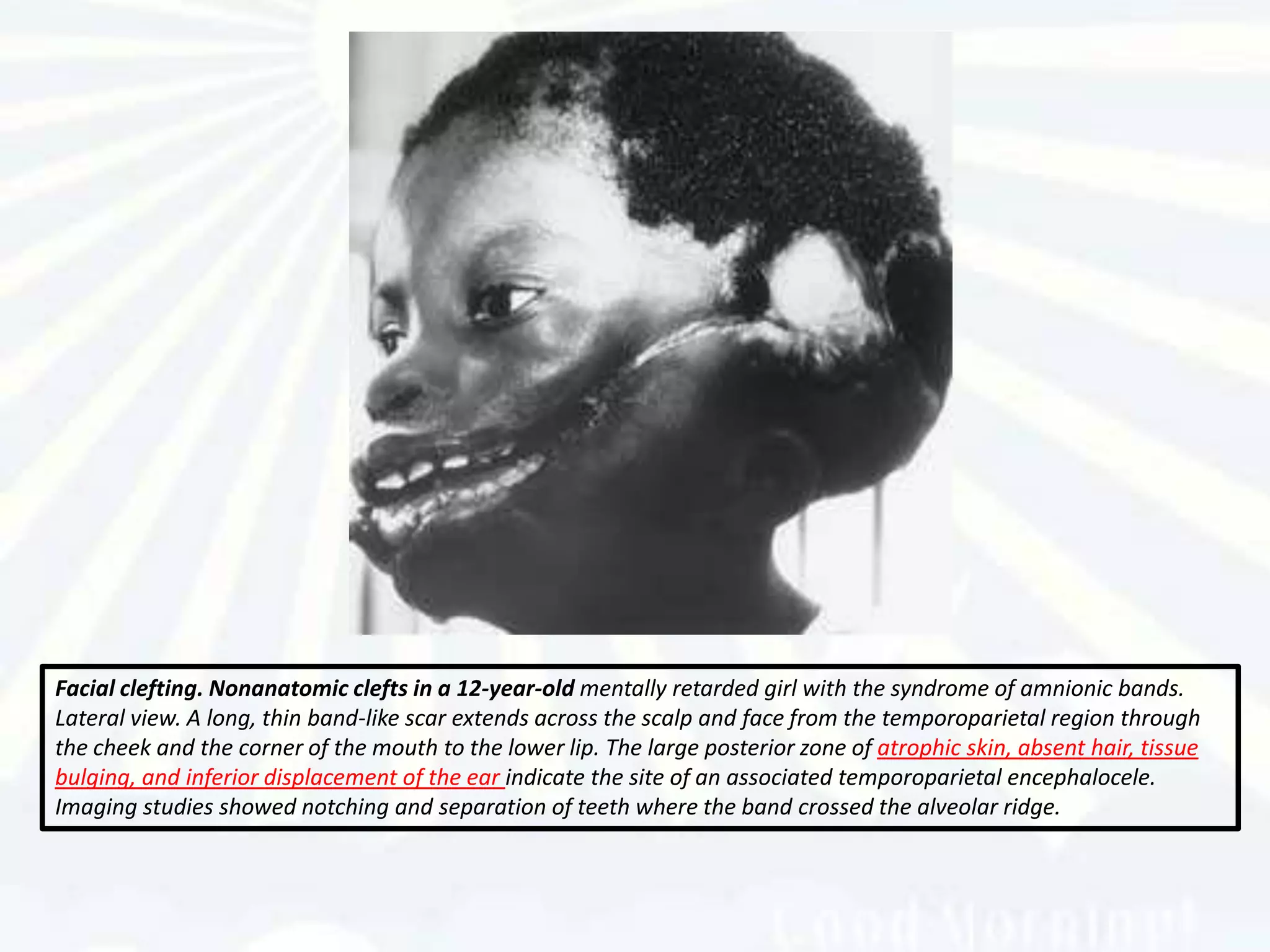 Development of face | PPTX