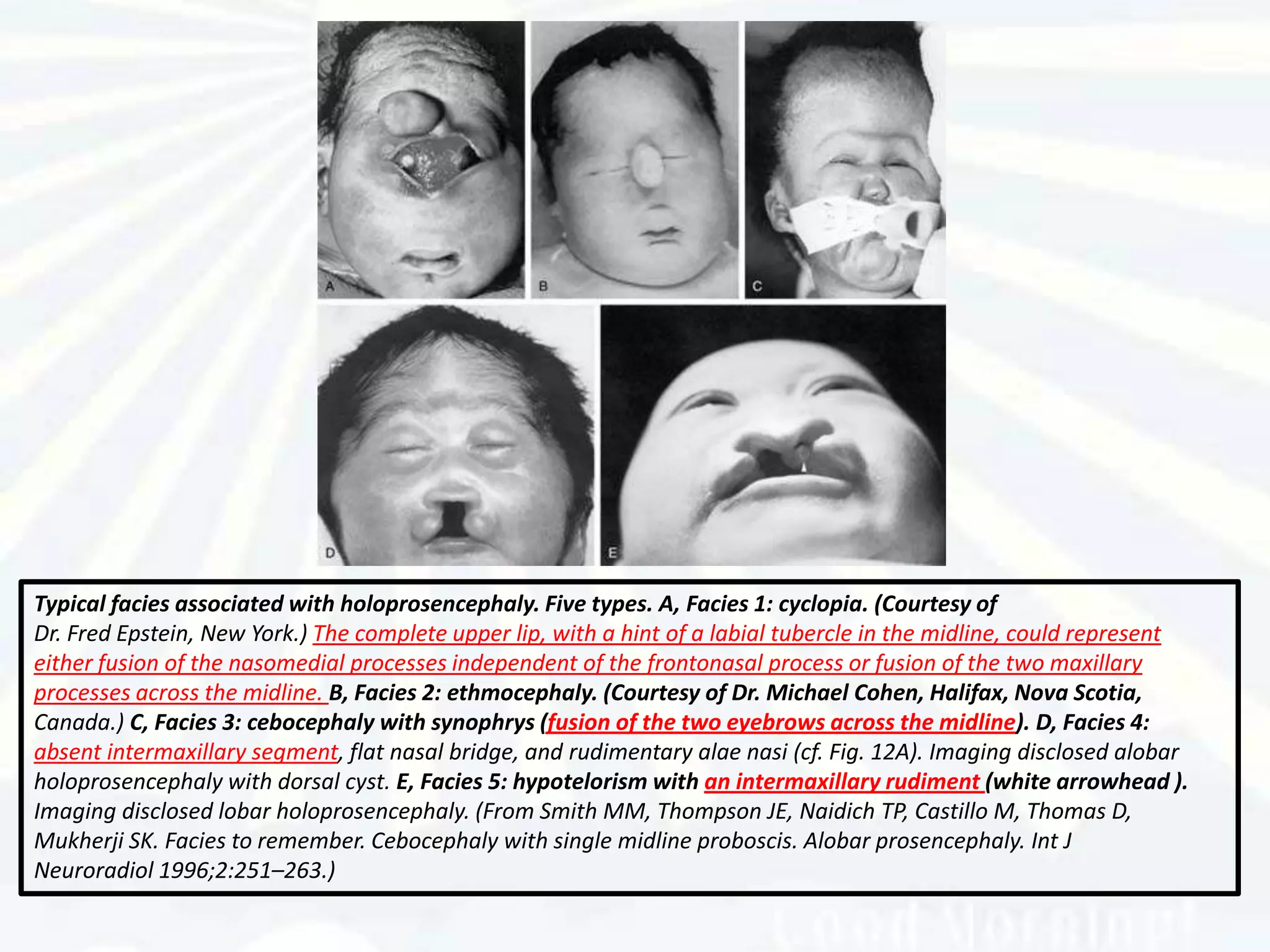 Development of face | PPTX