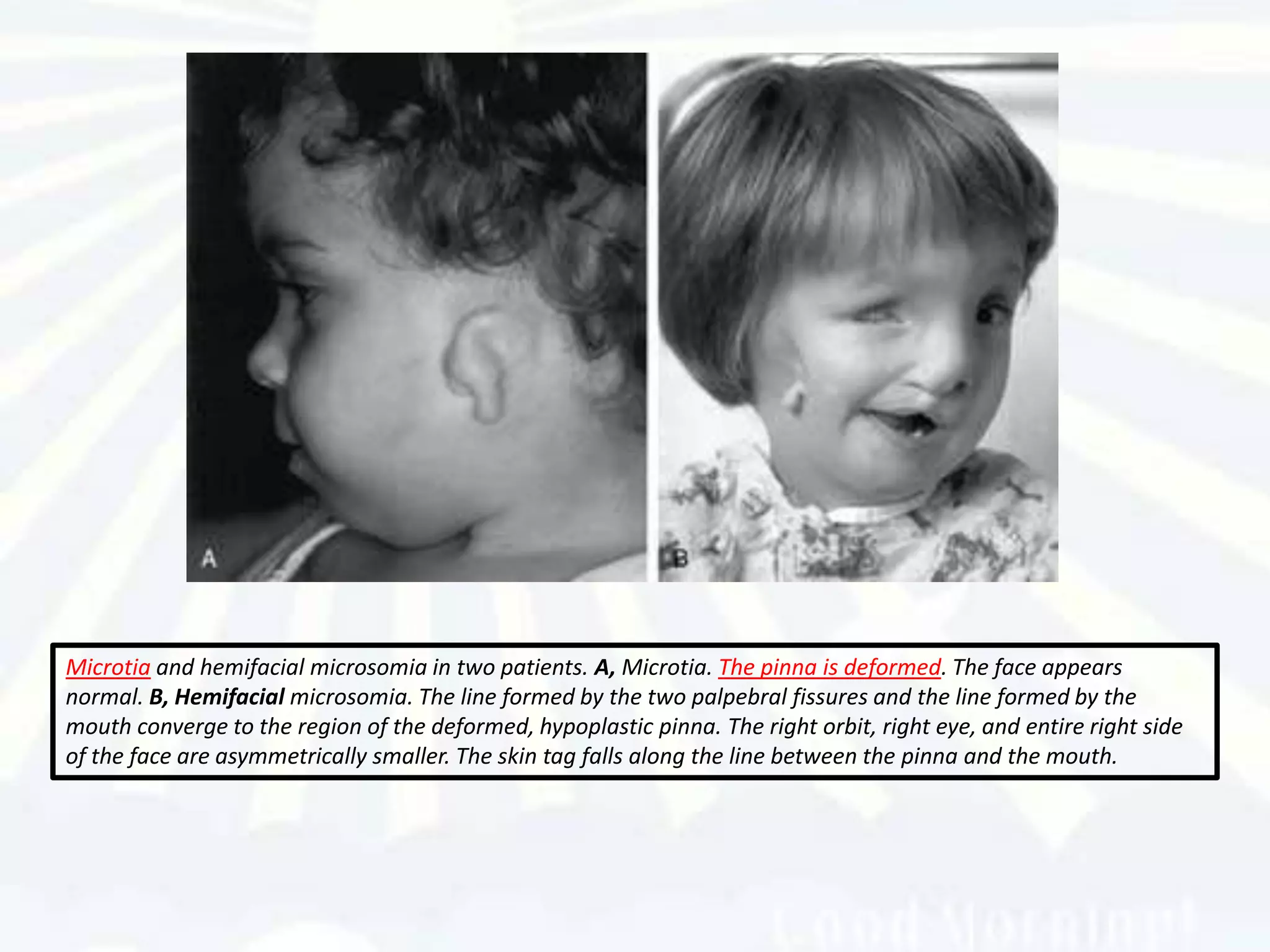 Development of face | PPTX