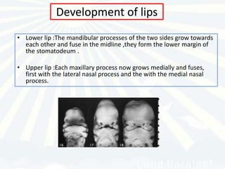 Development of face | PPTX