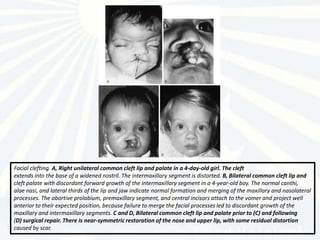 Development of face | PPTX