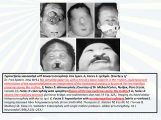 Development of face | PPT