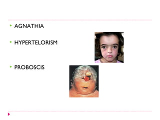 Development of face | PPT | Ear, Nose and Throat Conditions | Diseases ...