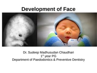 Development of face | ODP