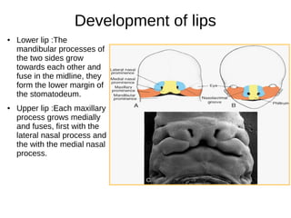 Development of face | ODP