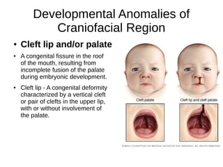 Development of face | ODP