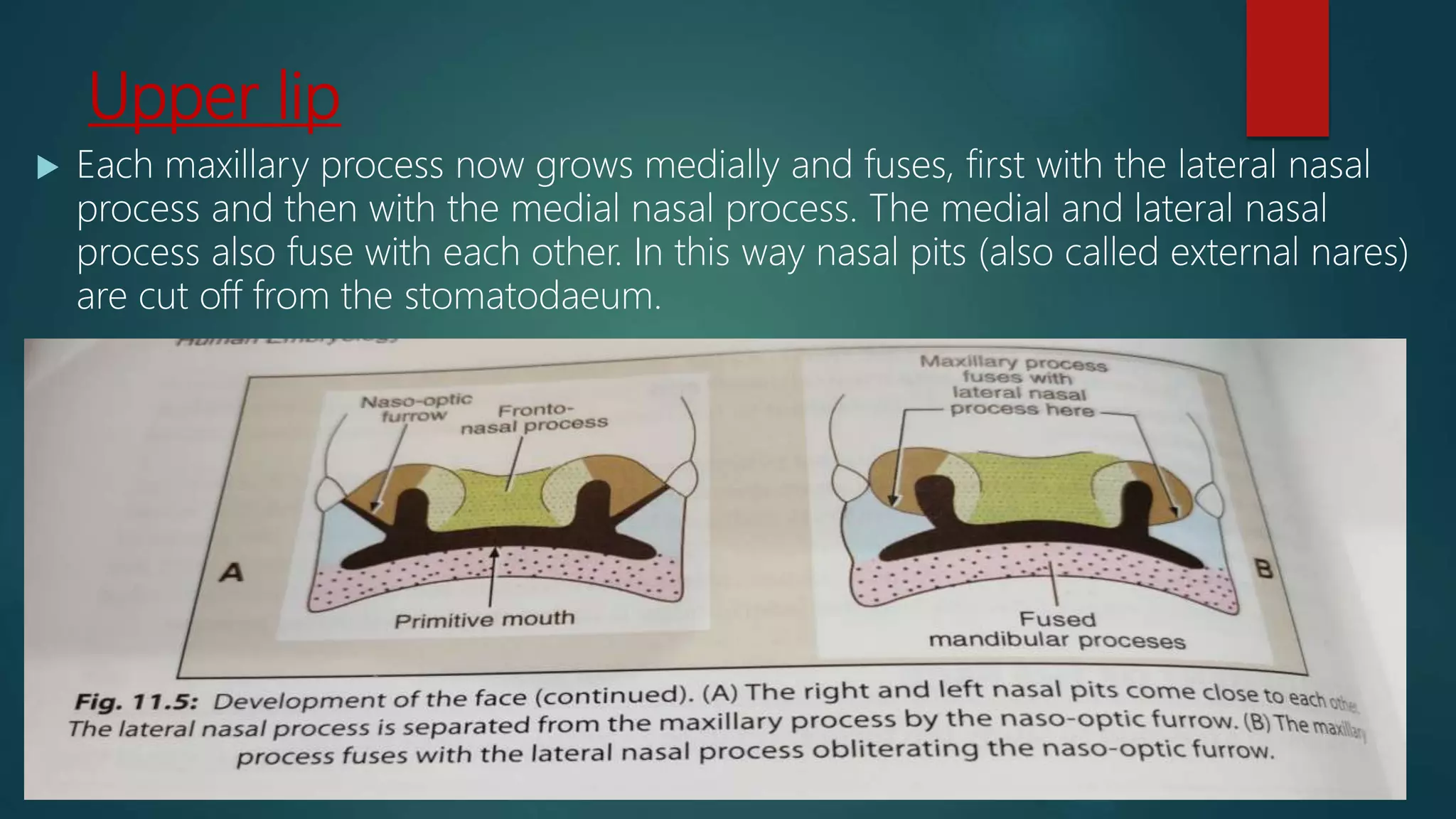 Development of face | PPTX