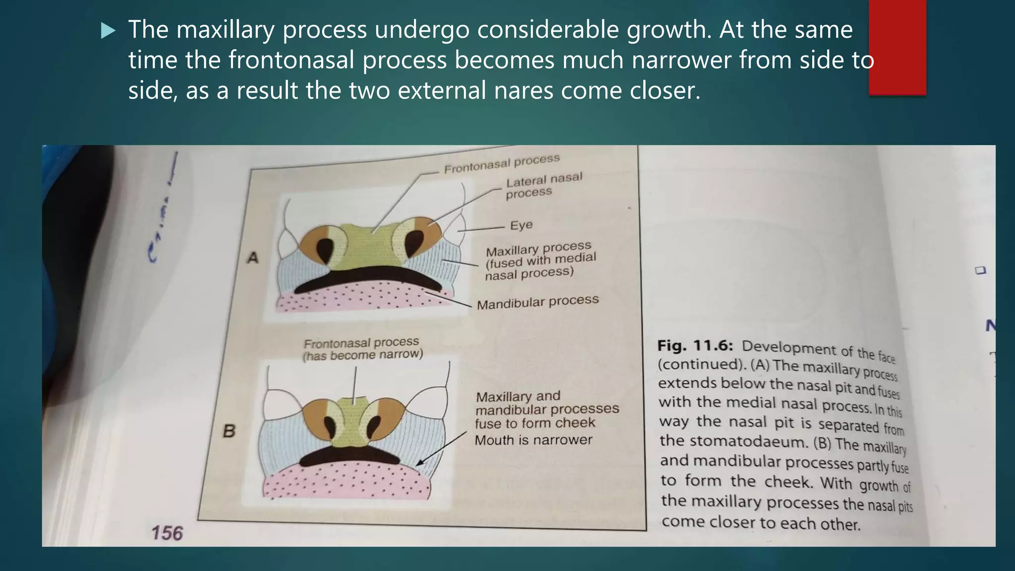 Development of face | PPTX