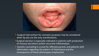 Development of face and palate | PPTX