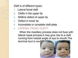 Development of face including nose ppt | PPTX