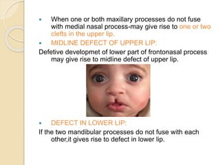 Development of face including nose ppt | PPTX