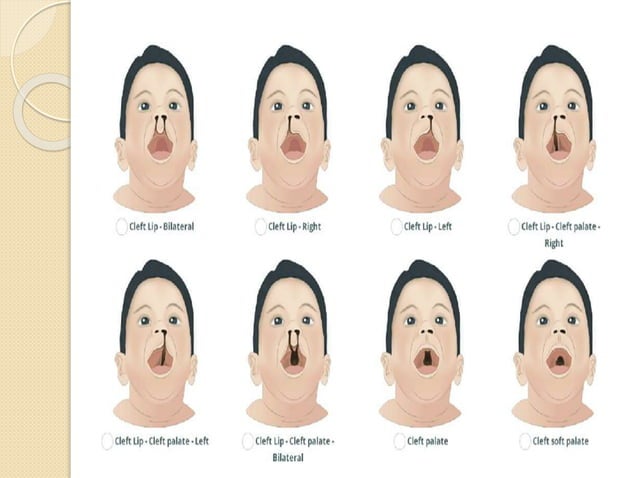 Development of face including nose ppt | PPT