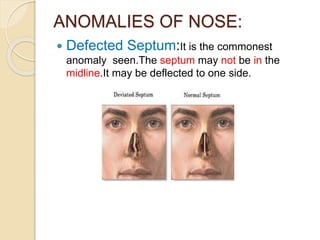 Development of face including nose ppt | PPTX