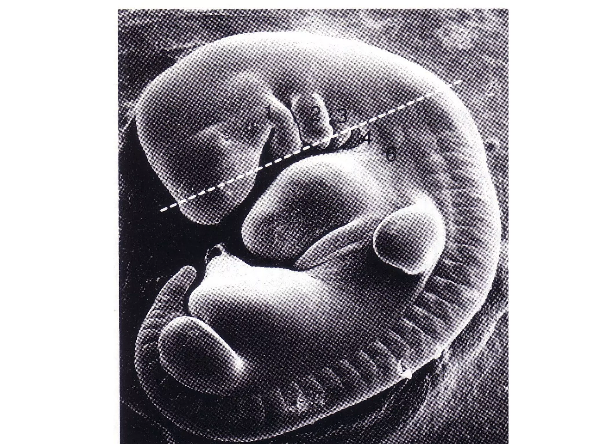 Development of Face, Nose and Palate (Special Embryology) | PPS