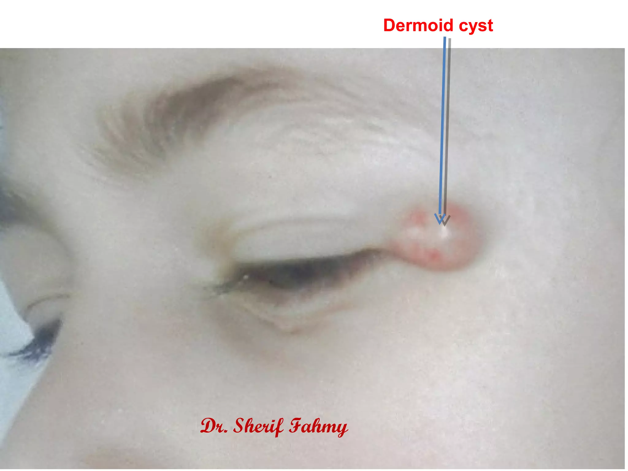 Development of Face, Nose and Palate (Special Embryology) | PPS