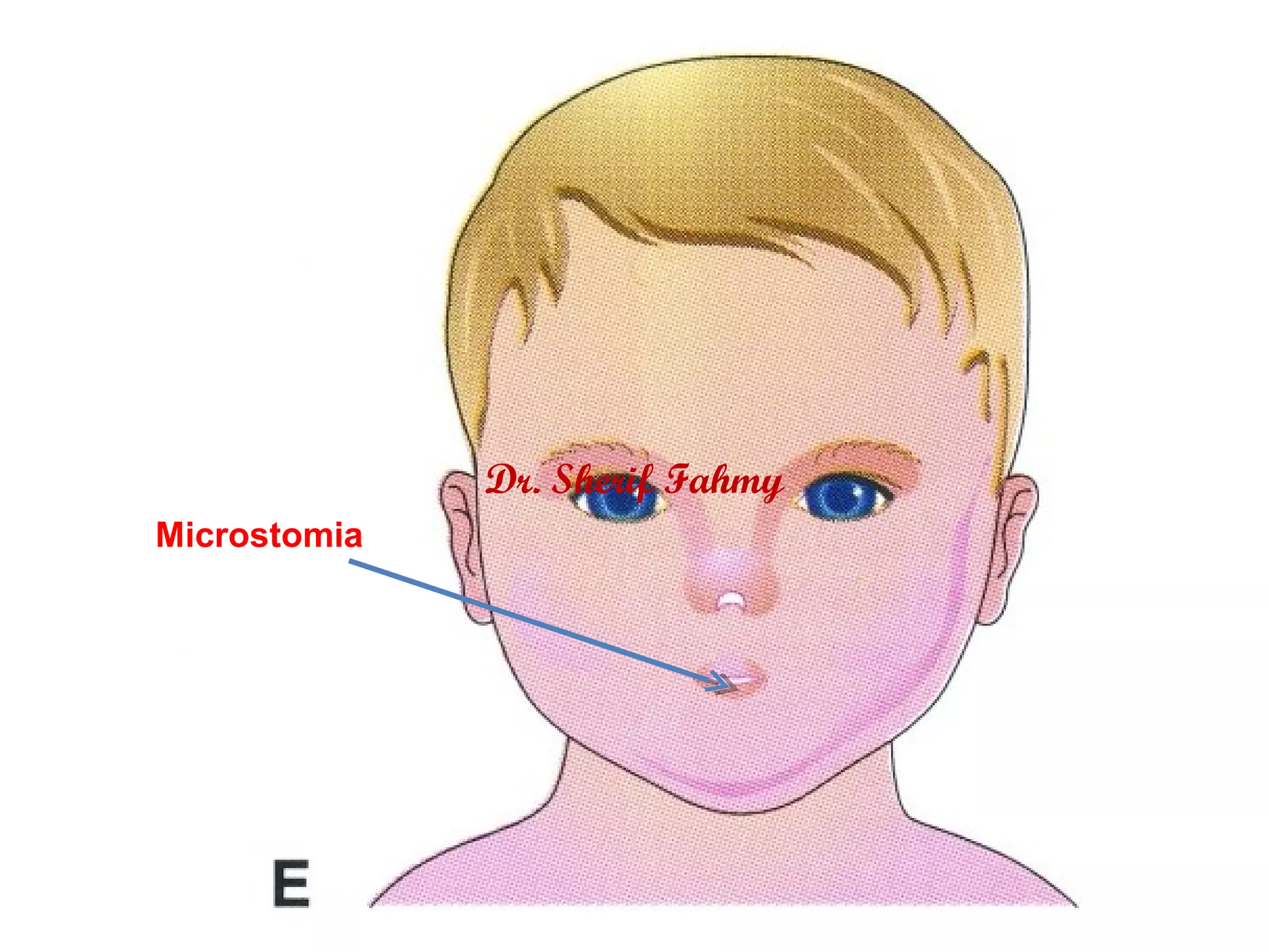 Development of Face, Nose and Palate (Special Embryology) | PPS