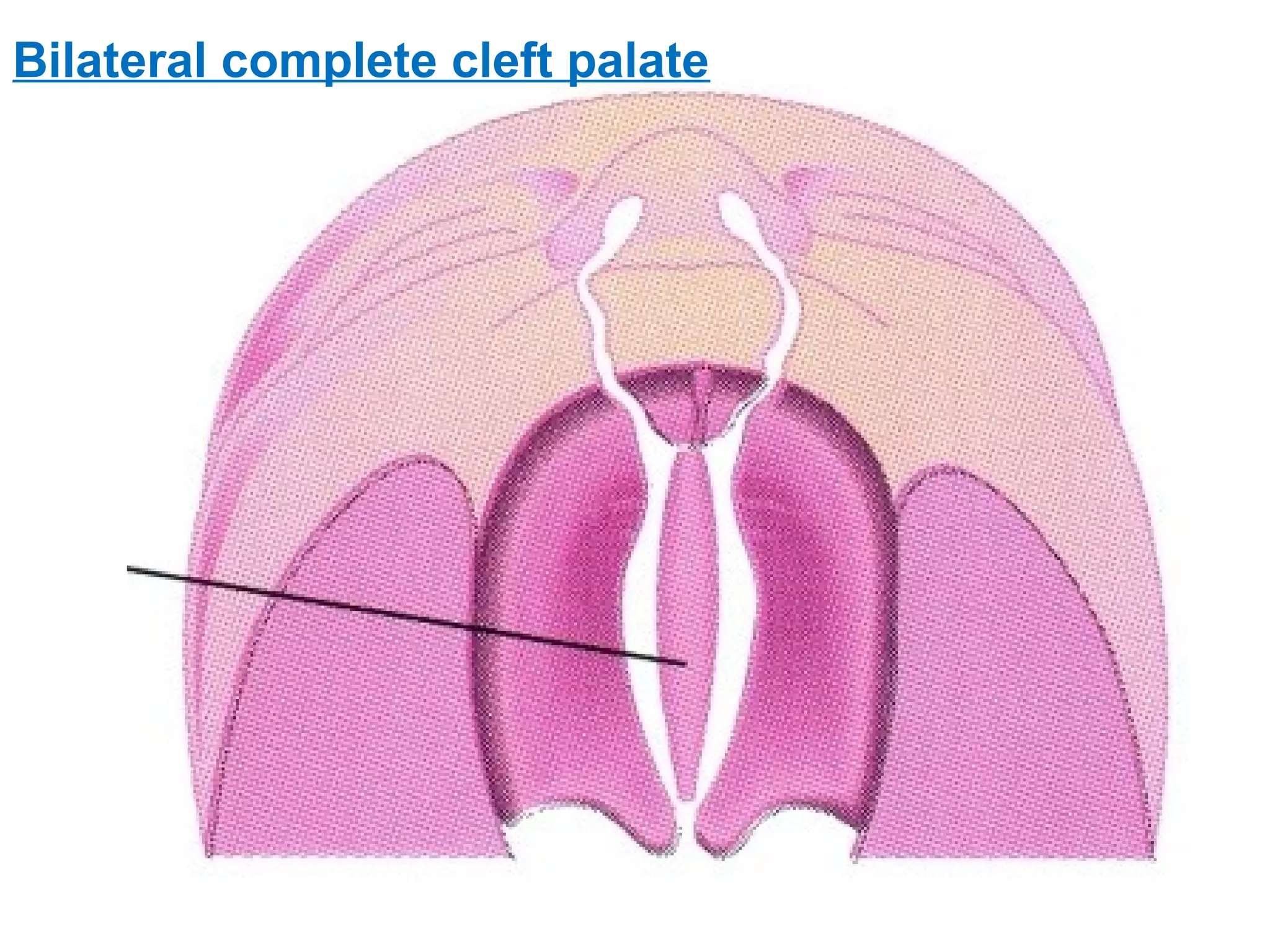 Development of Face, Nose and Palate (Special Embryology) | PPS