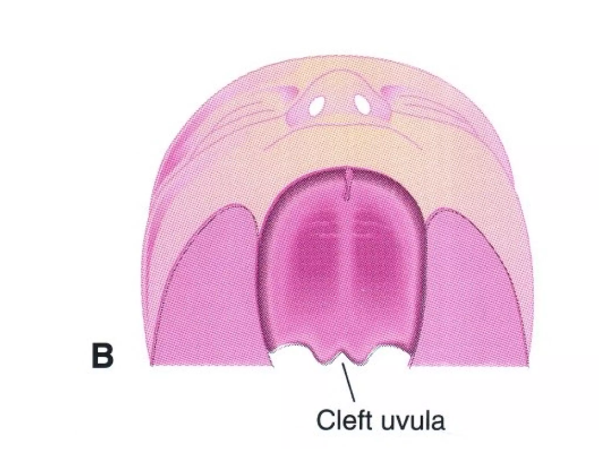 Development of Face, Nose and Palate (Special Embryology) | PPS