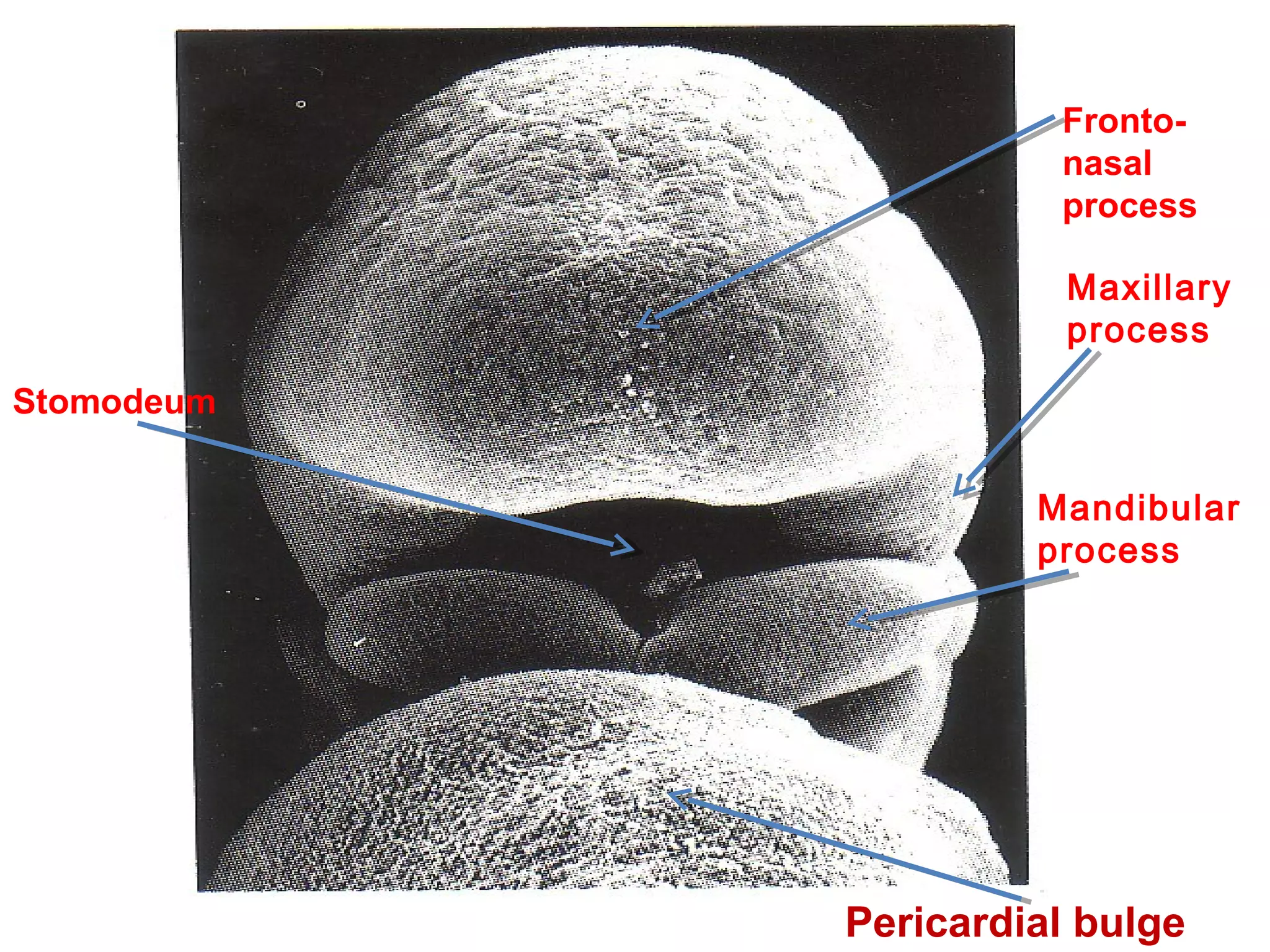 Development of Face, Nose and Palate (Special Embryology) | PPT