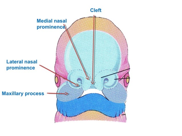 Development of Face, Nose and Palate (Special Embryology) | PPS | Ear ...