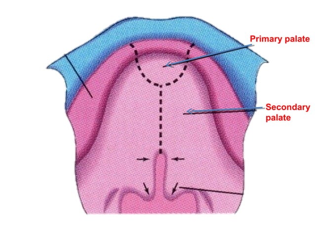 Development of Face, Nose and Palate (Special Embryology) | PPS | Ear ...