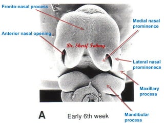Maxillary Process Embryology
