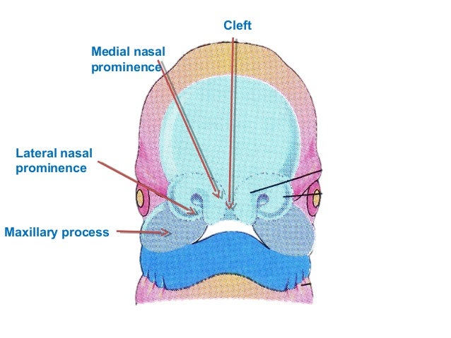 Development of Face, Nose and Palate (Special Embryology)