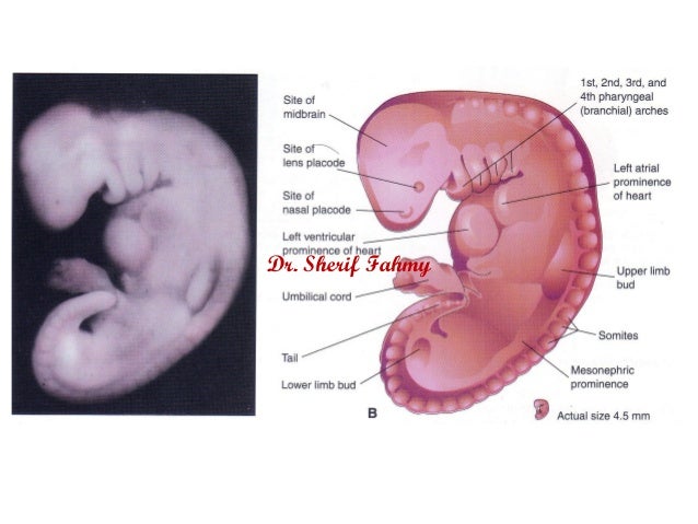 Development of Face, Nose and Palate (Special Embryology)