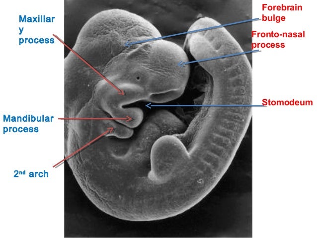 Development of Face, Nose and Palate (Special Embryology)