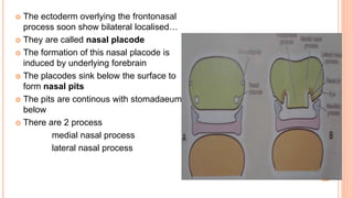Development of face, paranasal sinus. | PPTX