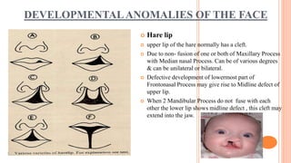 Development of face, paranasal sinus. | PPTX