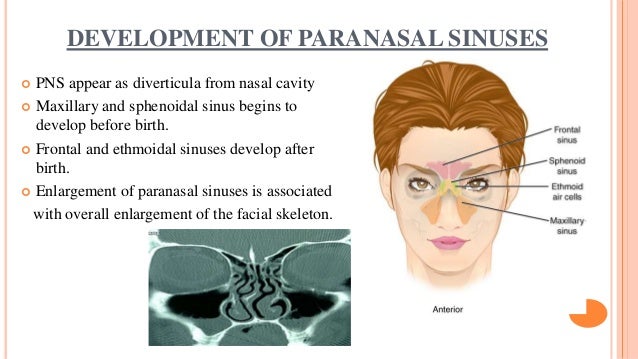 Development of face, paranasal sinus.